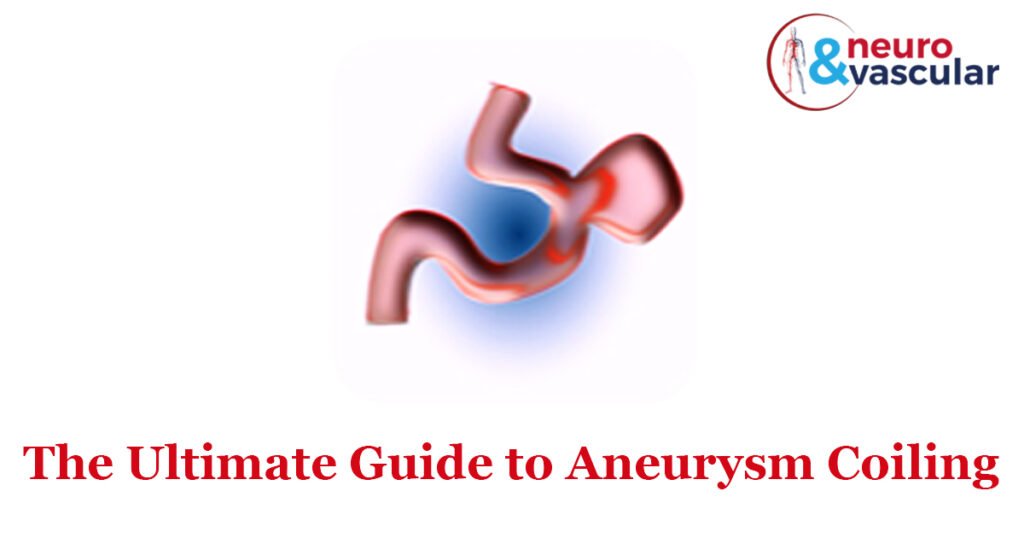 The Ultimate Guide to Aneurysm Coiling | Dr Suresh Giragani