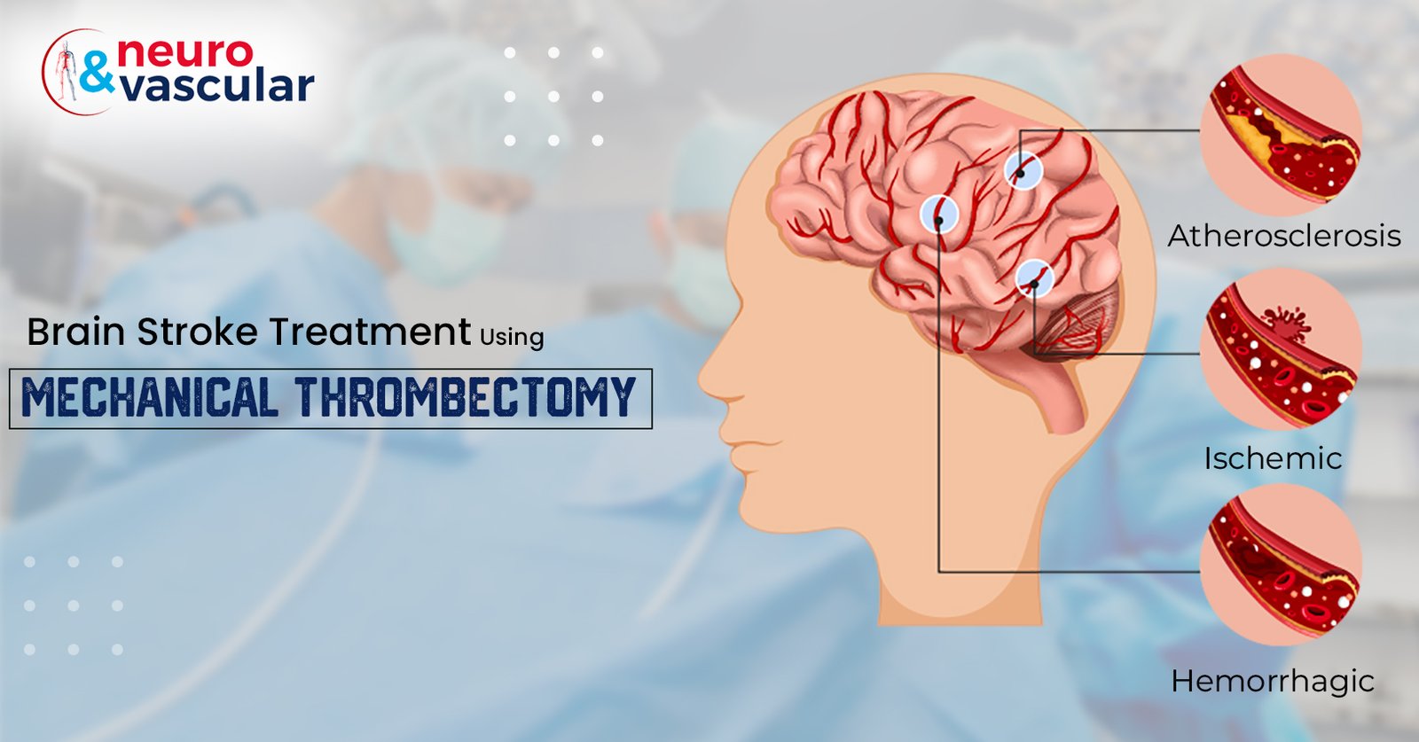 Thrombectomy Thrombectomy