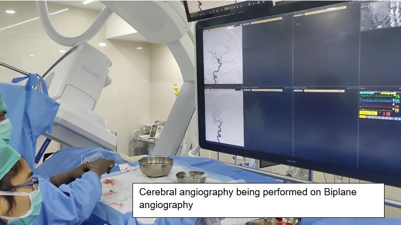 Applications of Bi-plane Angiography | DR. Suresh Giragani