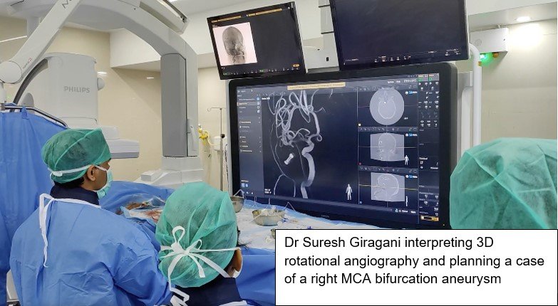 Advanced Neuroangio CT software based on Flat panel X ray | DR. Suresh ...